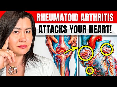 Rheumatoid Arthritis  Affects Your Heart Without You Even Knowing!