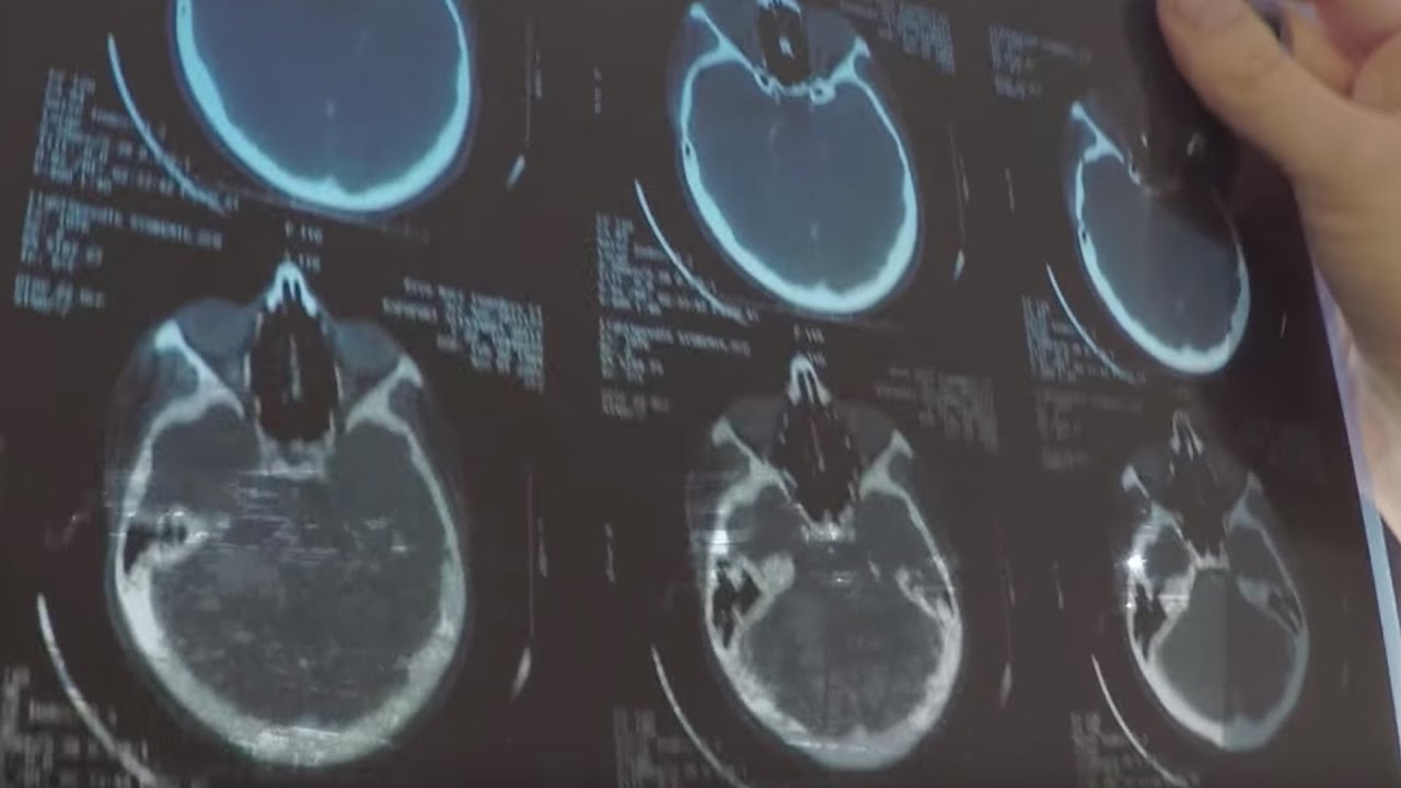 Mental Health & Behavioral Health Services at UC San Diego Health