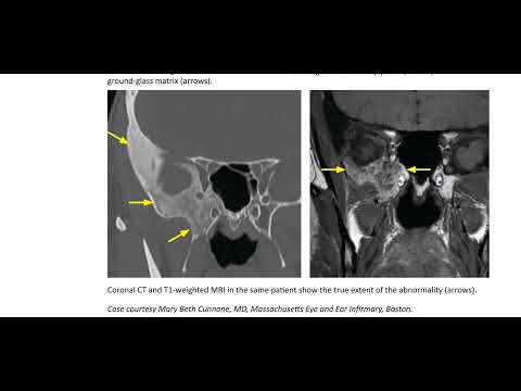 MSK imaging from core radiology visualsㅣradiopaedia@ctisus @navigatingradiology