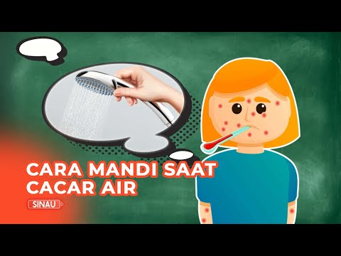 Penderita Cacar Air Boleh Mandi Asal Ikuti Cara Berikut Ini