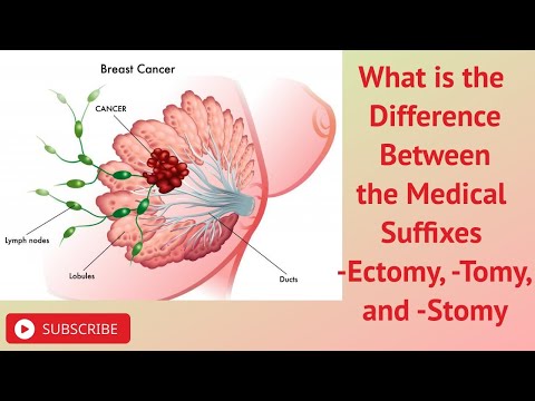 What is the Difference Between the Medical Suffixes Ectomy, Tomy, and Stomy