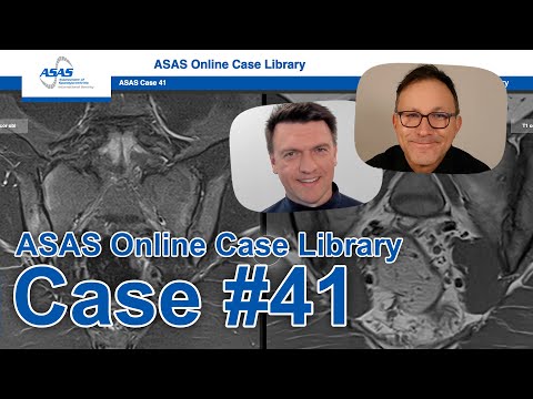 Case 41 of the ASAS Online Case Library // Demonstration by Denis Poddubnyy and Kay G. Hermann