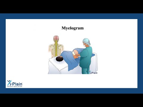 Myelogram
