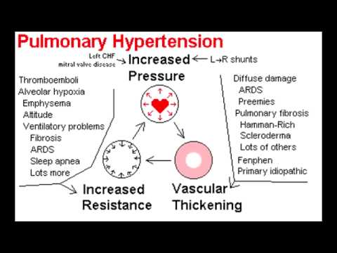 Pulmonary Hypertension - Primary & Secondary