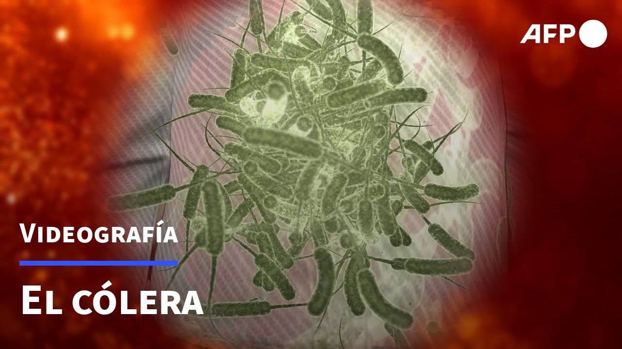 El cólera | AFP
