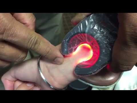 How to use VeinLite EMS Vein Finder - BROOKLYN MEDICAL EDUCATION