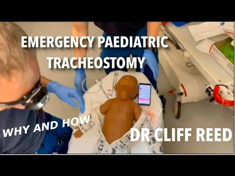 Paediatric emergency front of neck access – Prehospital and Retrieval ...