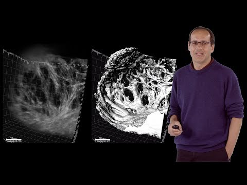 Didier Stainier (MPI) 1: Vertebrate Organ Development: The Zebrafish Heart