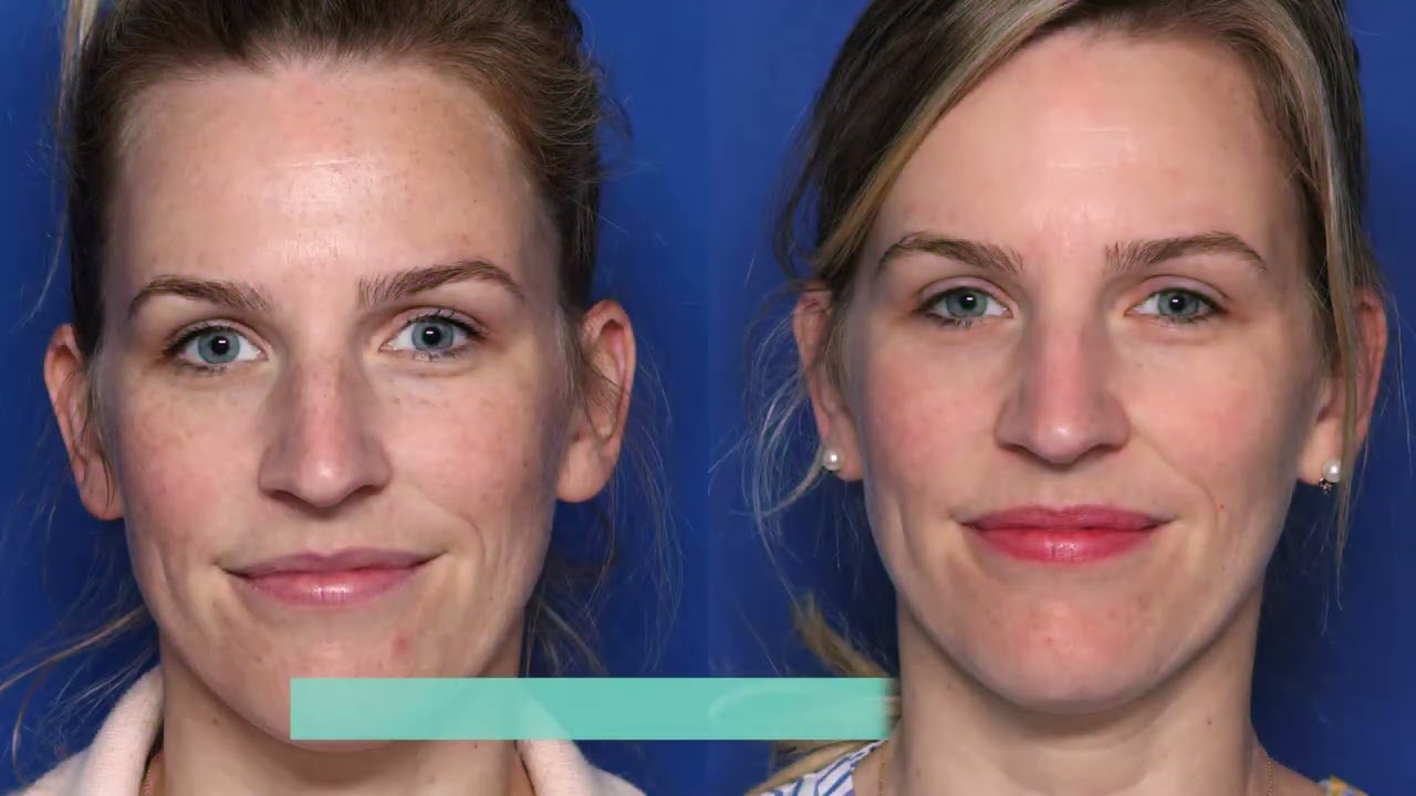 Plastic Surgery in Columbus | Ohio Plastic Surgery Specialists