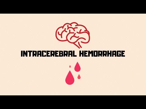 Intracerebral hemorrhage | Causes | Different sites of involvement | Diagnosis | Treatment |